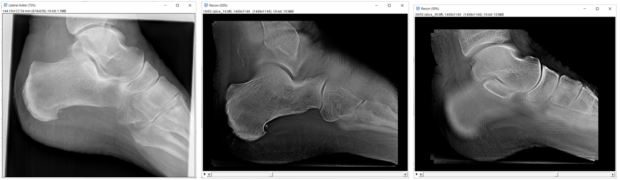 X-ray technology from space – UK Space Agency blog