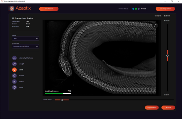 X-ray technology from space – UK Space Agency blog